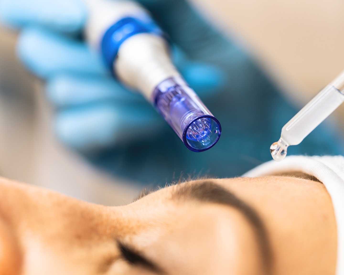 Meso Therapy - 180 One Eighty Clinic